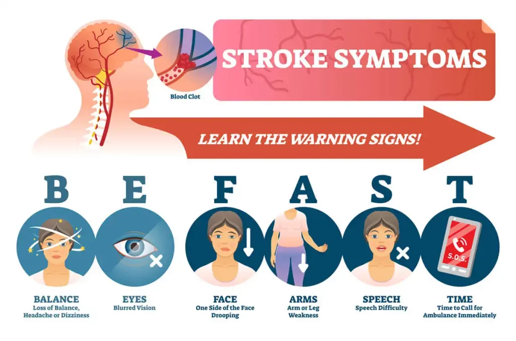 World Stroke Day 2021