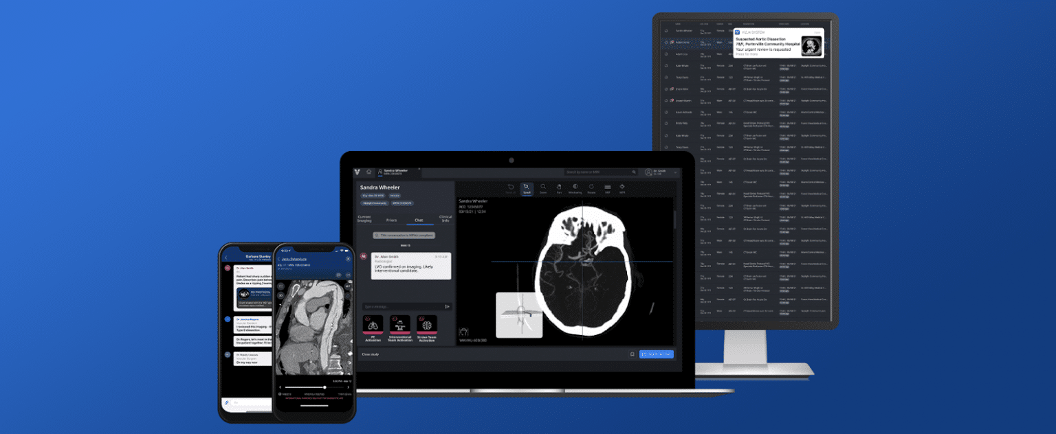 AI for Radiology, on the proven Viz.ai platform