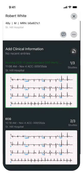 Automated Hypertrophic Cardiomyopathy Analysis Using Ai