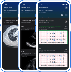 Viz™ Cardio | AI-Powered Neurovascular Care Coordination