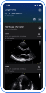 Viz™ Cardio | AI-Powered Neurovascular Care Coordination
