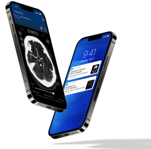 Viz.ai, the proven AI-powered care coordination platform