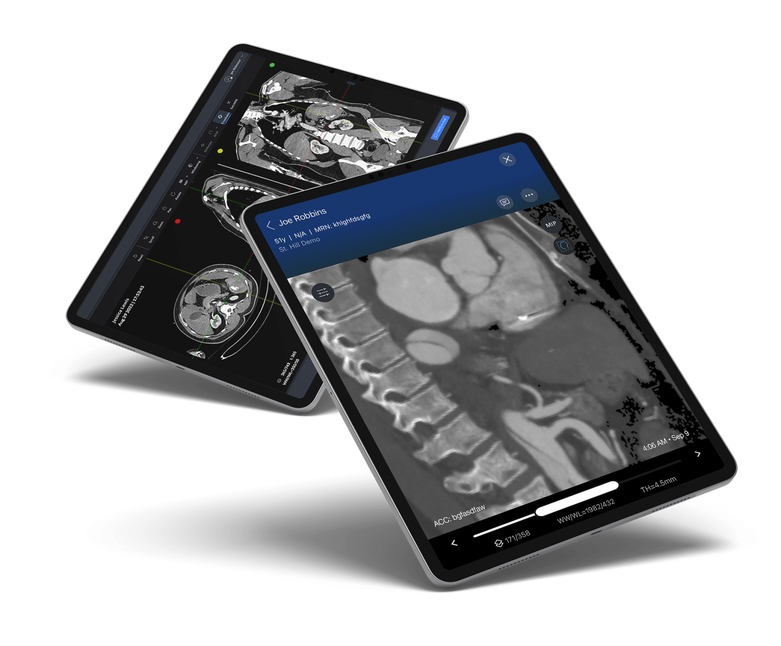 Viz.ai, the proven AI-powered care coordination platform