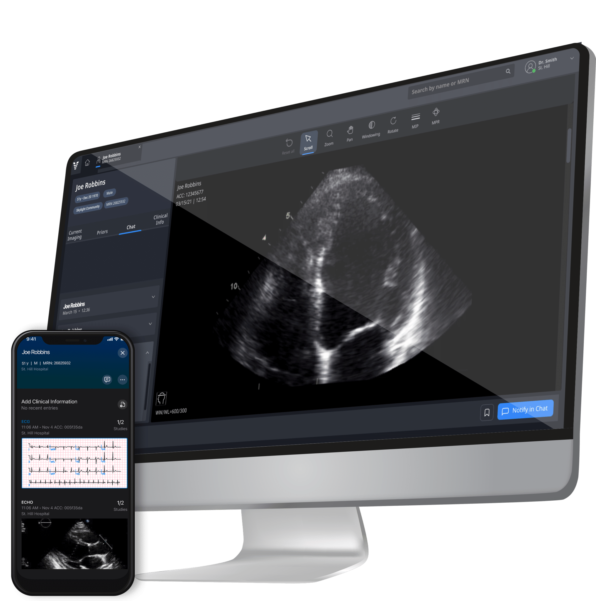 Viz HCM Automated hypertrophic cardiomyopathy analysis using AI