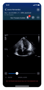 Viz HCM Automated hypertrophic cardiomyopathy analysis using AI
