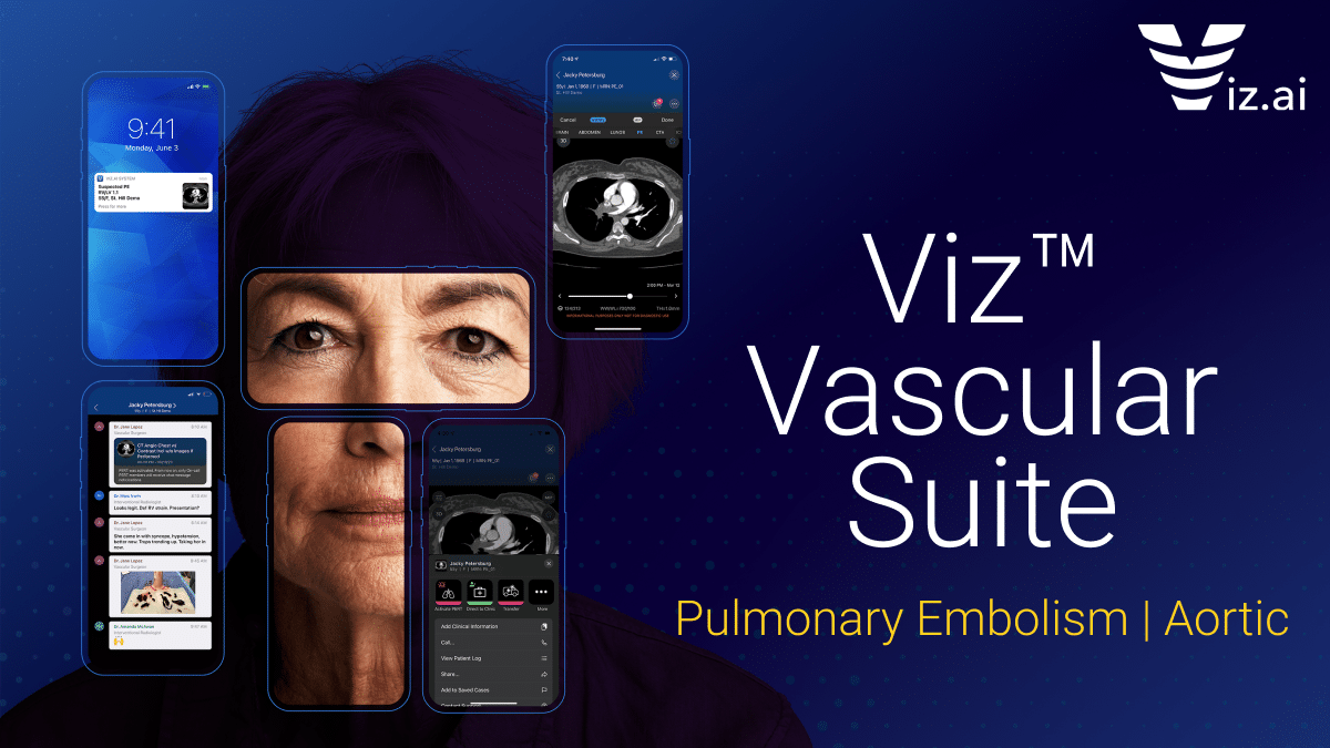 Viz™ Vascular | AI-Powered Care Coordination