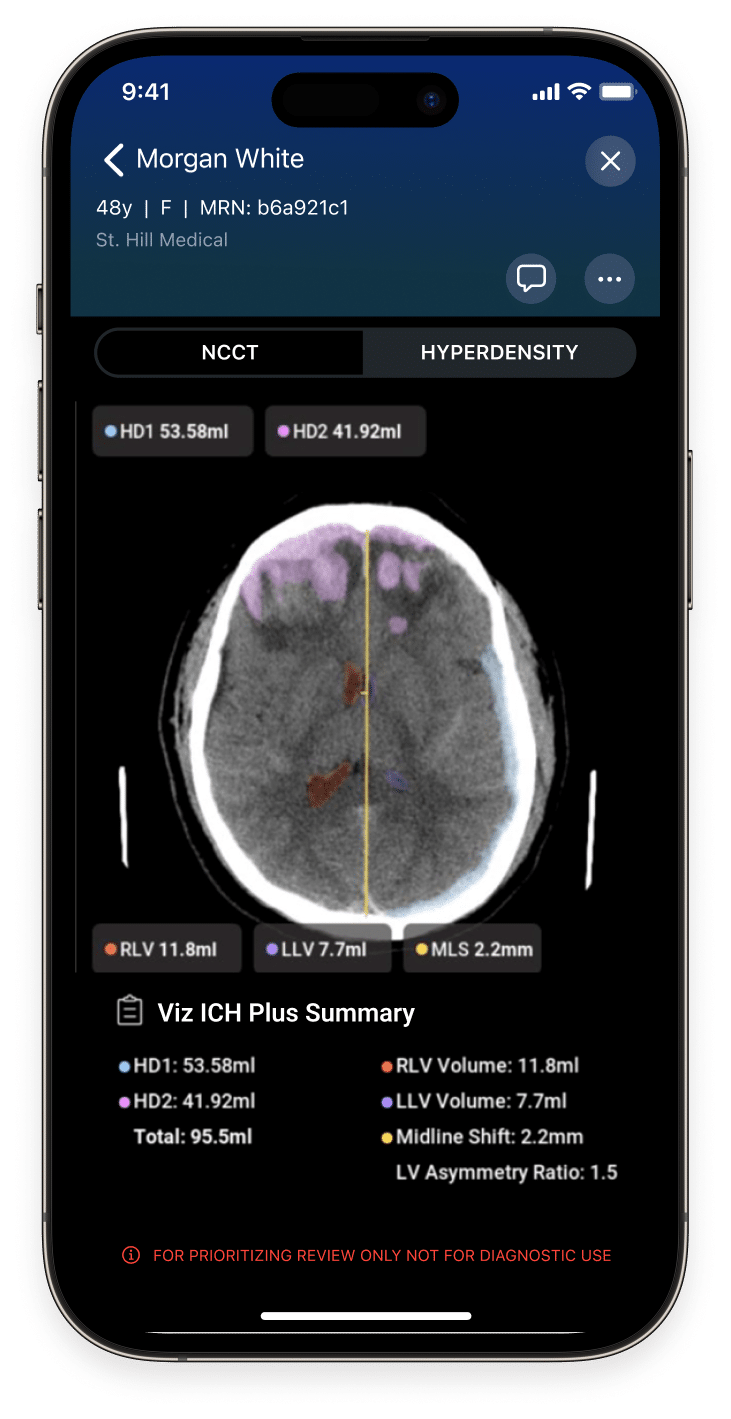 Viz.ai Receives FDA 510(k) Clearance for Artificial Intelligence ...