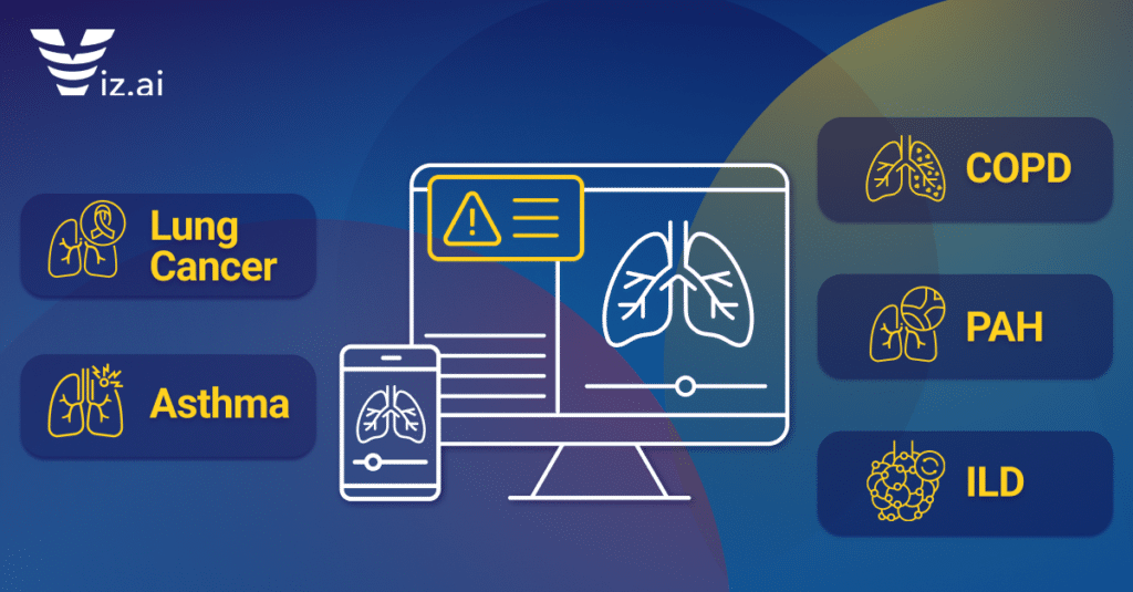 Unlocking the Potential of AI in Lung Disease Diagnosis and Care ...