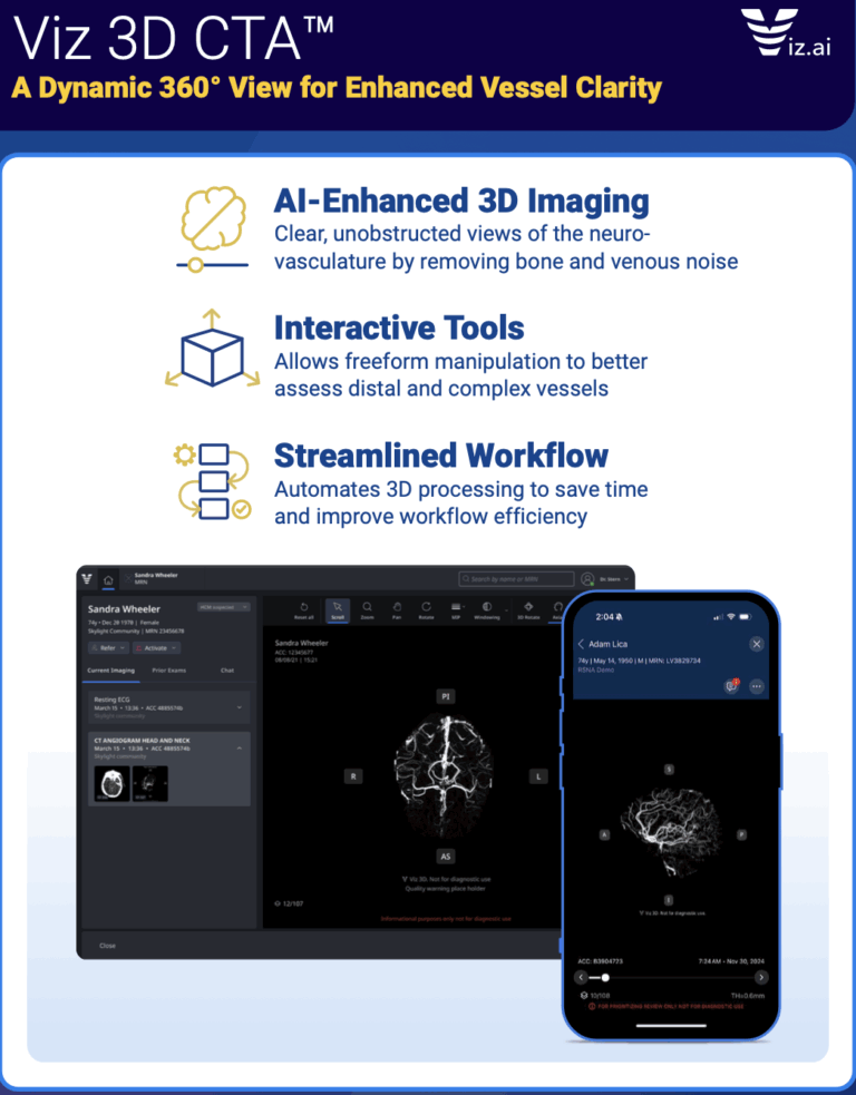 Viz 3D CTA™ - Viz.ai, the Proven AI-Powered Care Coordination Platform